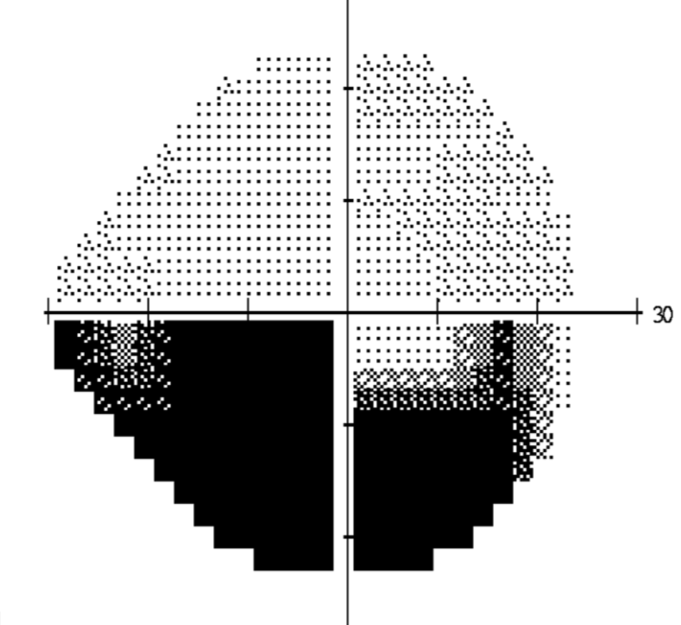 Champ visuel : intérêt et conseils pratiques